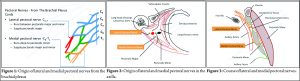 Peripheral nerve stimulator guided pectoralis (PEC-I) block: A novel ...
